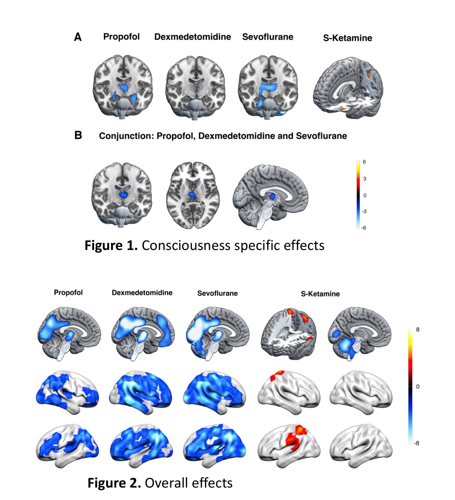 New Insights into Anesthesia and Consciousness - Turku Brain and Mind ...